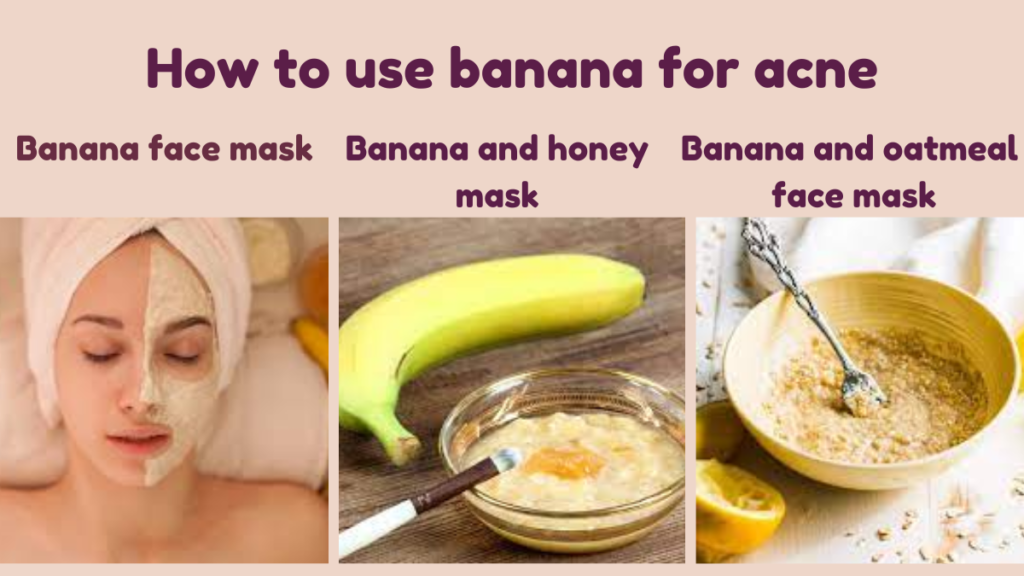 Amazing Benefits of Banana for Acne - Banana Dose